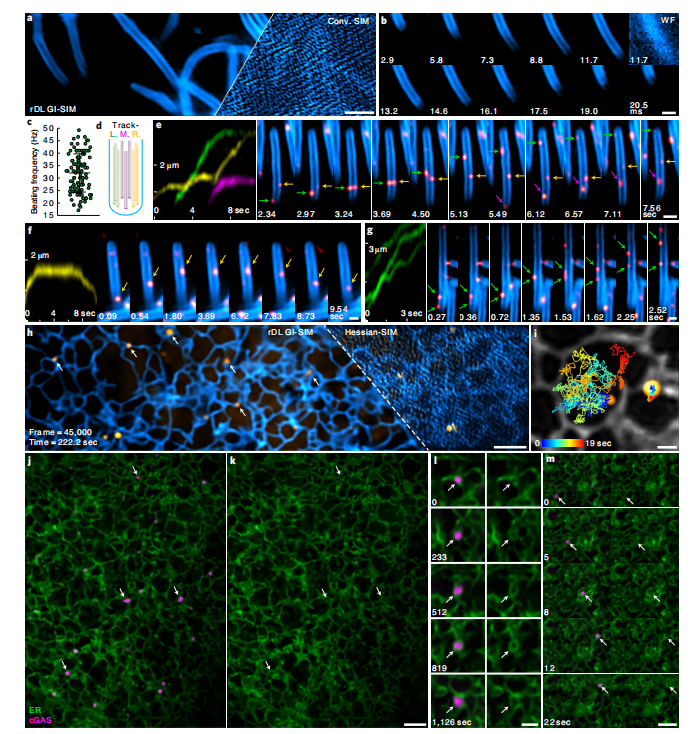 Nat. Biotechnol. | 用于快速亚细胞过程持续实时成像的合理化深度学习超分辨率显微镜 - 知乎