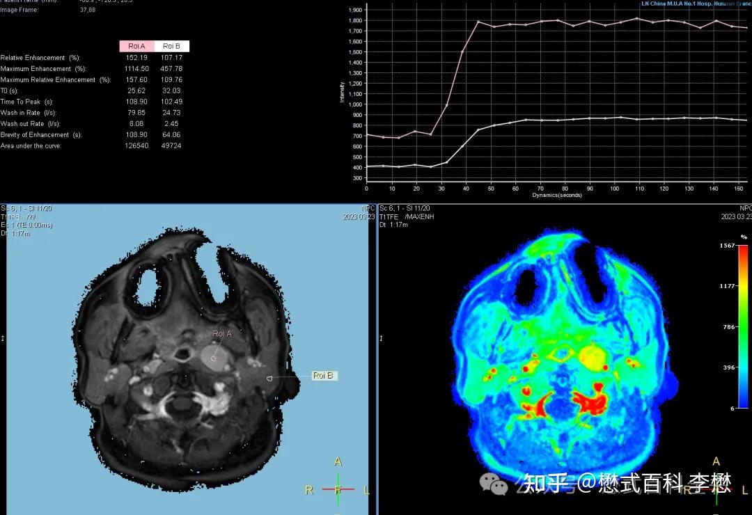 磁共振动态扫描 MRI Dynamic Scan