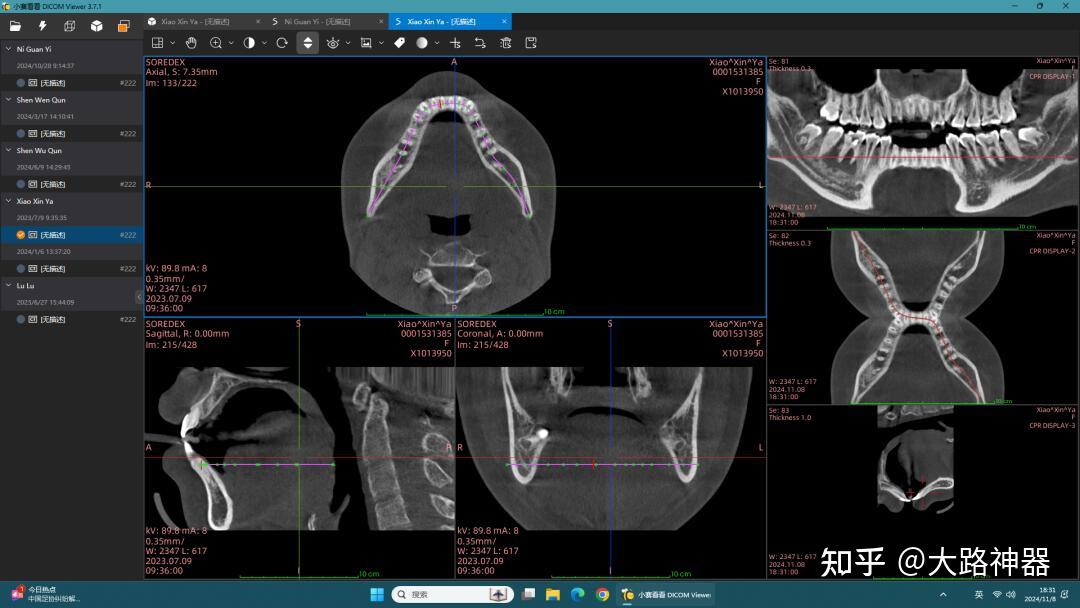 dcm是什么格式？怎么从医院拷贝dicom？医院dcm文件在电脑怎么打开？ - 知乎