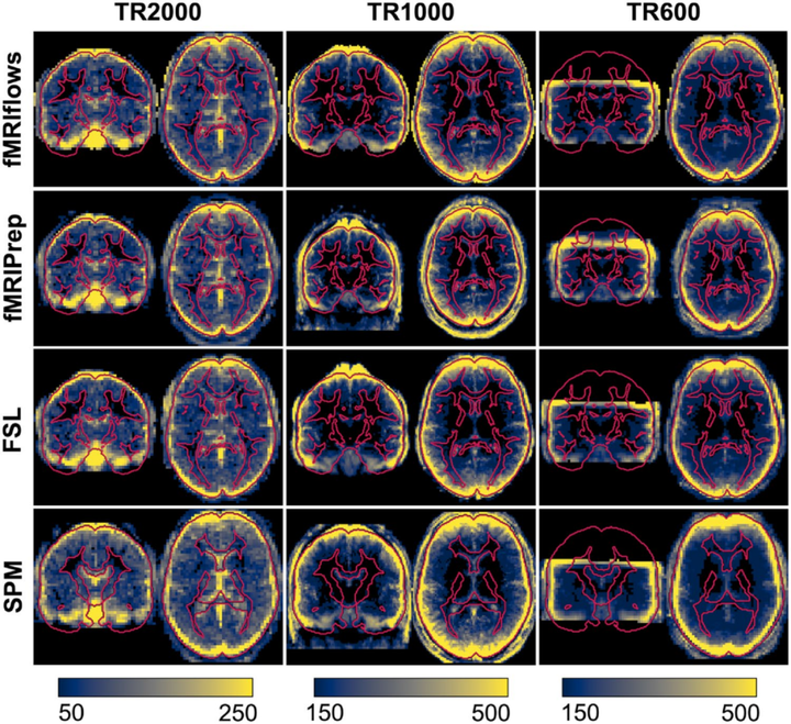 fMRIflows：全自动单变量和多变量fMRI处理管道的联合体 - 知乎