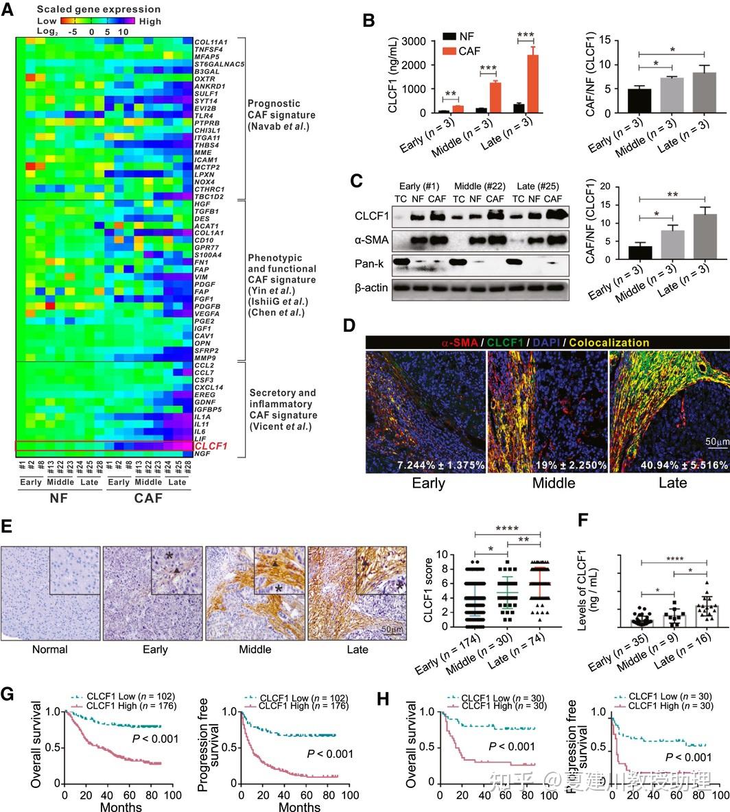 夏建川教授团队研究之：首次发现CAF细胞能促进肝癌免疫抑制微环境的形成！ - 知乎