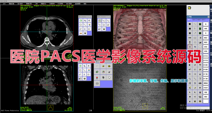大型医院影像PACS系统三维重建技术（获取数据、预处理、配准、重建和可视化） - 知乎