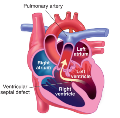 LMCHK-DAY4 Cardio embryology - 知乎