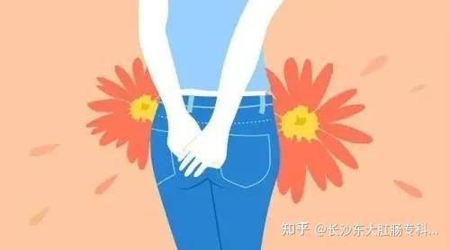 长沙东大肛肠科普：肛门周围瘙痒暗示哪些疾病？ 知乎 7342