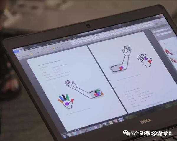 深度解析|智能假肢：生肌电控制机器人手臂 - 知乎