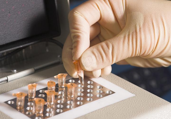 保姆级PCR教程，看完秒上手！ - 知乎