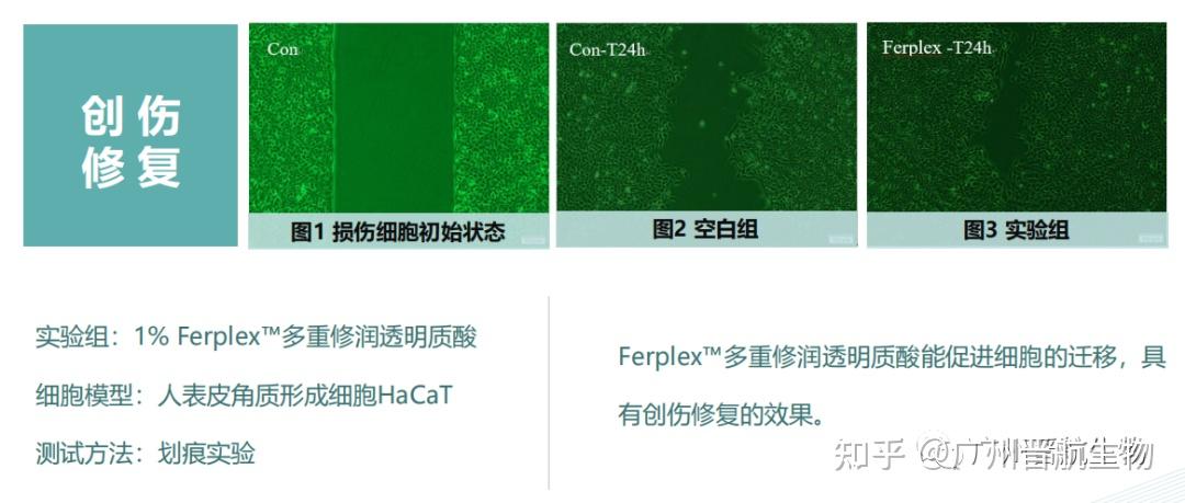 Ferplex™多重修润透明质酸 - 知乎