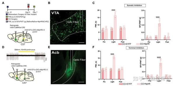 徐州医科大学麻醉学院曹君利课题组揭示VTA-NAc谷氨酸能投射调节疼痛和疼痛相关的焦虑 - 知乎