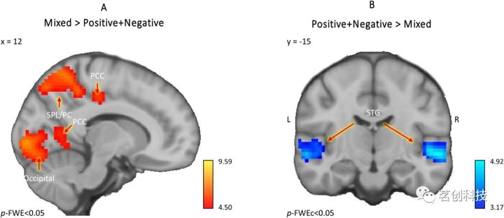 fMRI研究 | 社交情境下的混合情绪 - 知乎