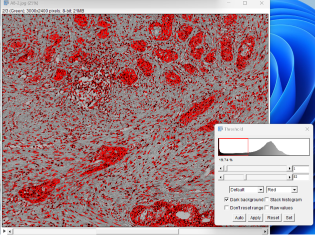 解忧小工具｜保姆式教程！用Image J进行免疫组化分析（IHC score评分） - 知乎