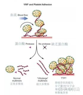 我所认识的血栓性血小板减少紫癜（TTP） - 知乎