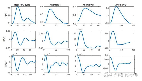 PPG信号与血压 - 知乎