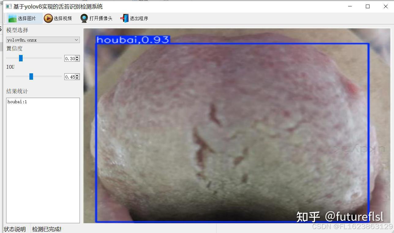 基于yolov8的舌苔识别检测系统python源码+onnx模型+评估指标曲线+精美GUI界面 - 知乎