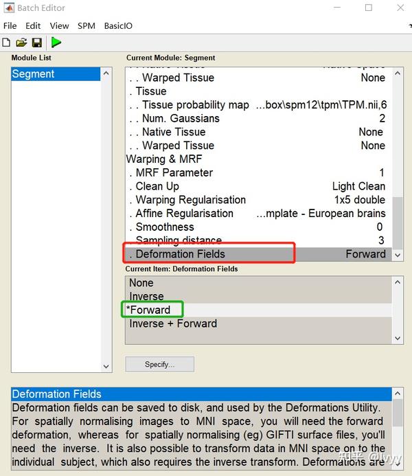 SPM数据预处理 -单被试 - 知乎