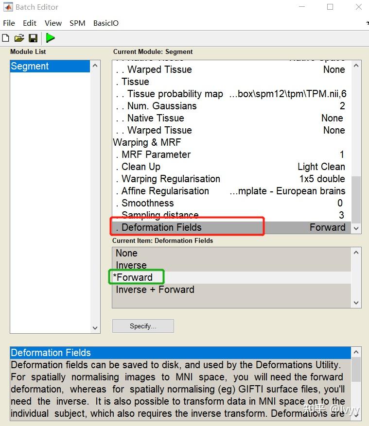 SPM数据预处理 -单被试 - 知乎