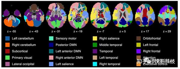 中国成人脑白质分区与脑功能图谱 - 知乎