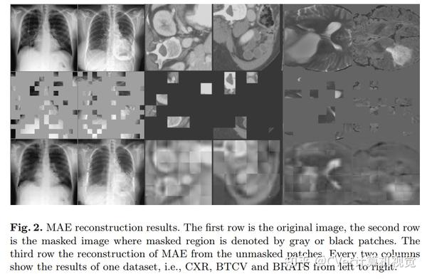 SBU&上交提出：使用 MAE 进行医学图像分析的自预训练 - 知乎