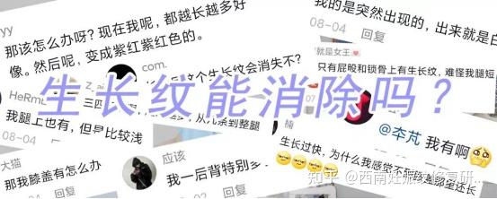 长了生长纹不要害怕,可以这样淡化它 知乎