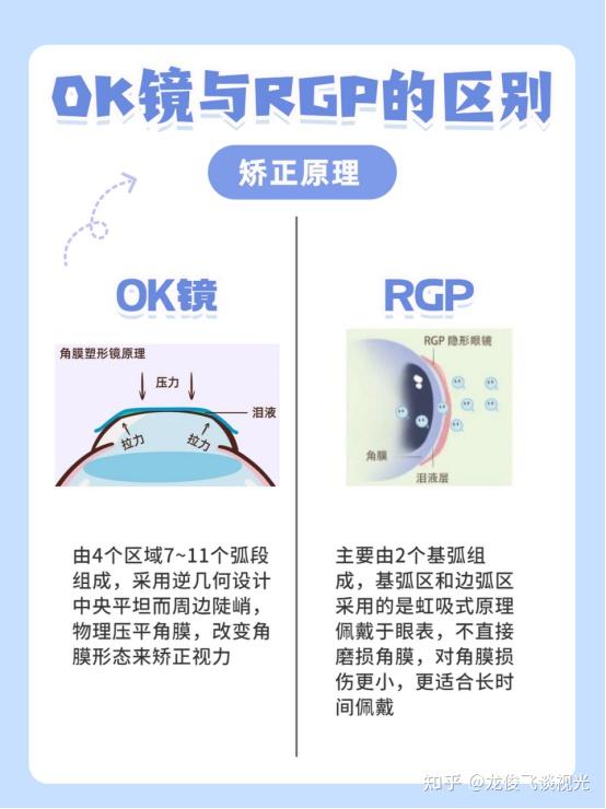 角膜塑形镜和RGP到底有什么区别？选哪种？ - 知乎