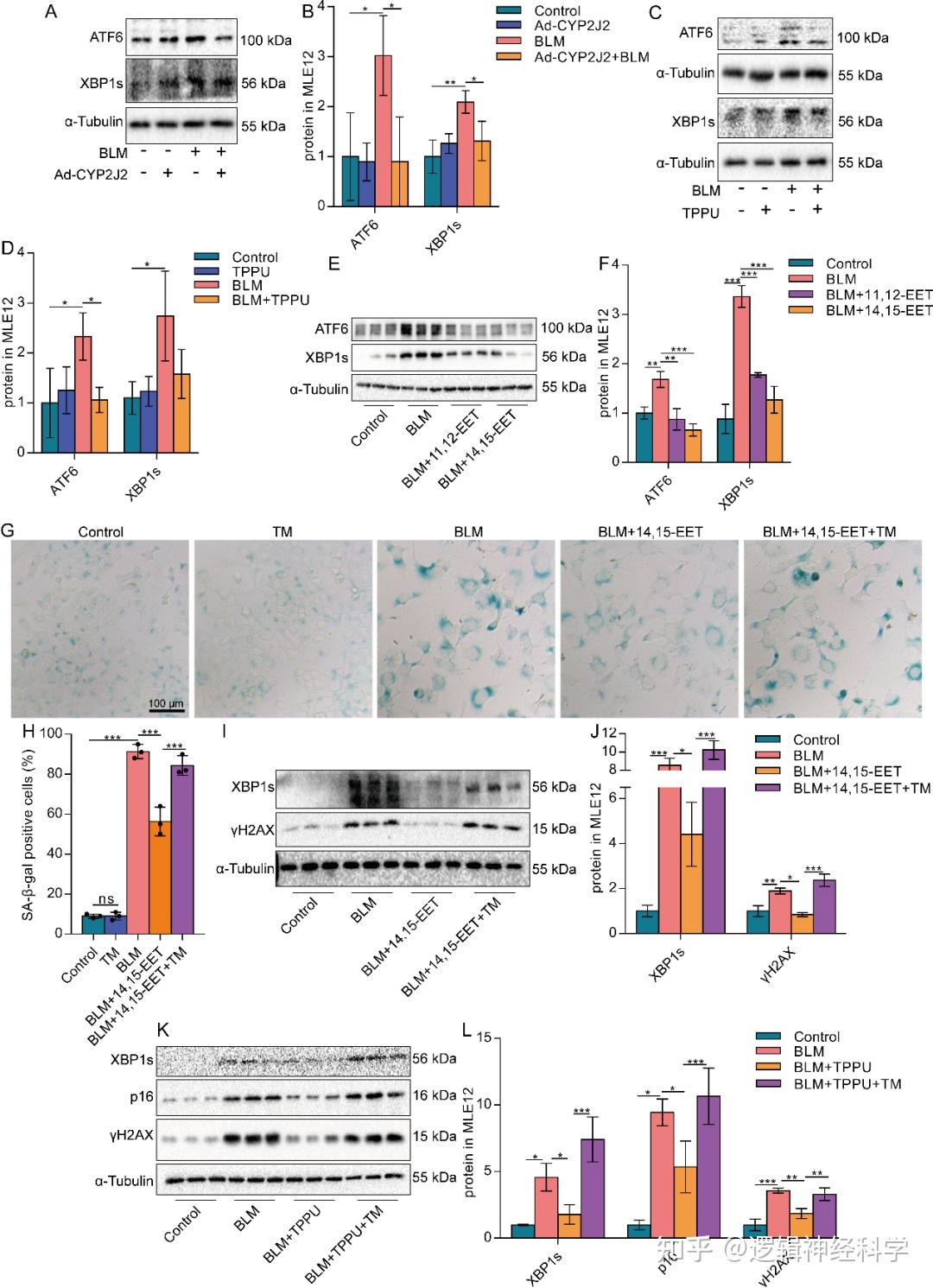 Redox Biol︱中南大学管茶香团队揭示抗肺衰老新机制 - 知乎