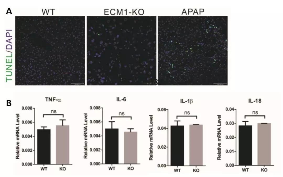 Gastroenterology | 南模生物助力揭示ECM1在肝纤维化疾病进展中的调控机制和功能 - 知乎