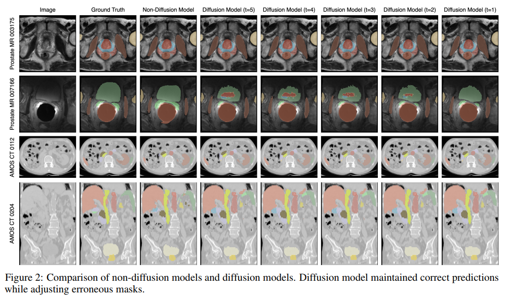 ImgX-DiffSeg：基于 DDPMs 的 3D 医学图像分割 - 知乎