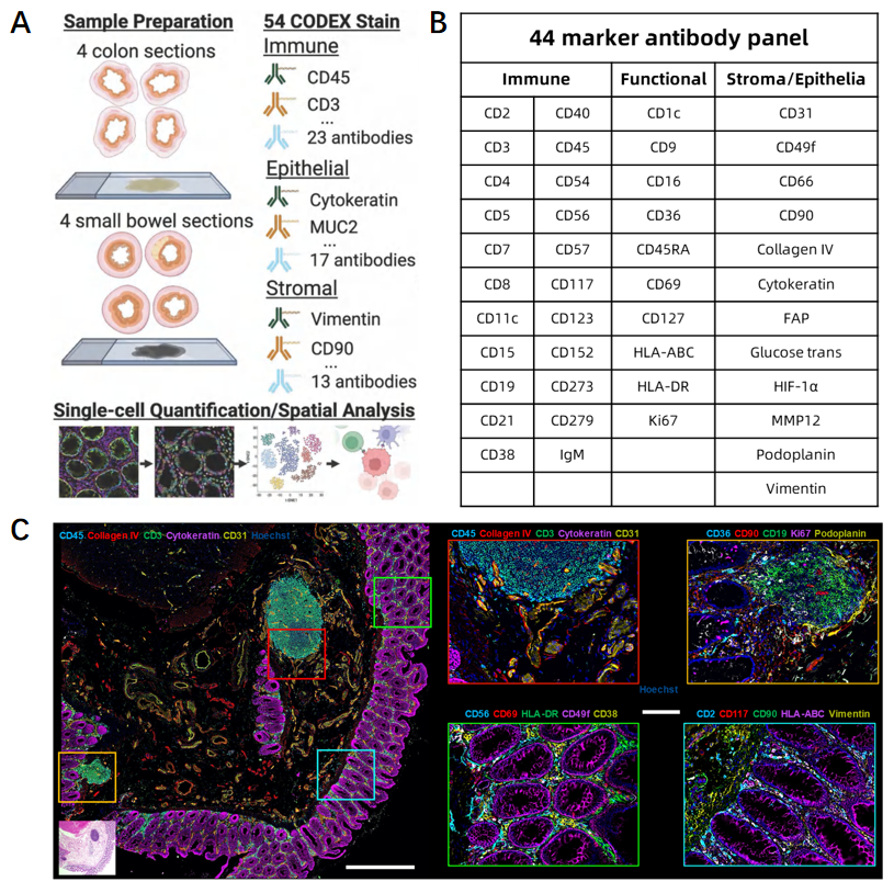 Nature：PhenoCycler-Fusion空间单细胞蛋白组学（简称PCF,原CODEX）构建肠道组织结构图谱 - 知乎