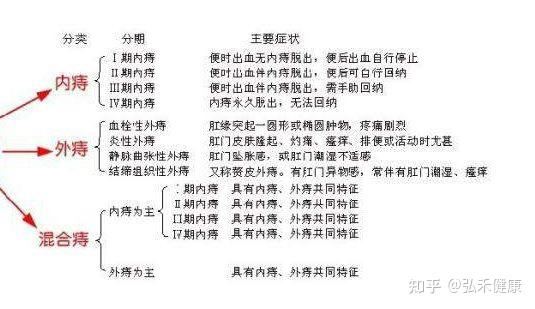 治疗痔疮有特效药吗 知乎 3092
