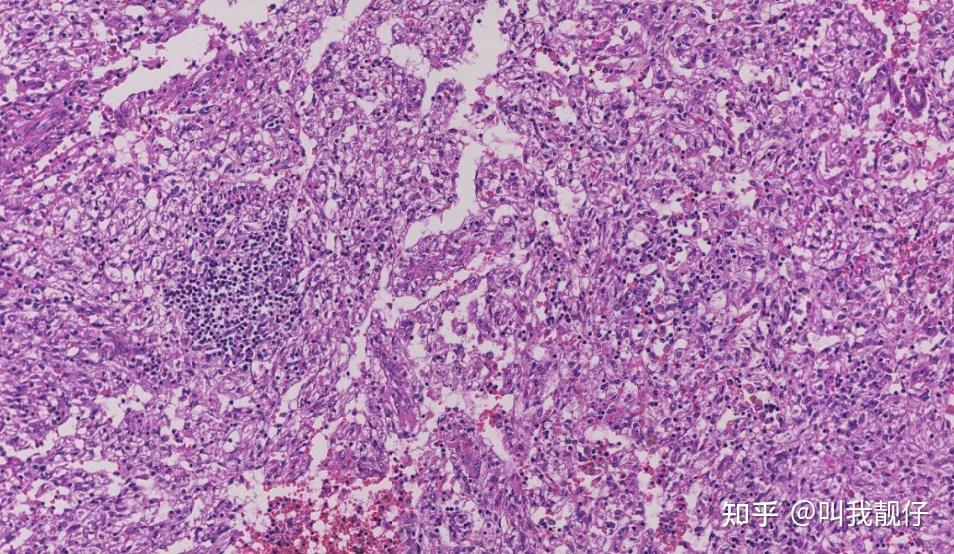 病理基础染色之HE染色 | 病理交流 - 知乎