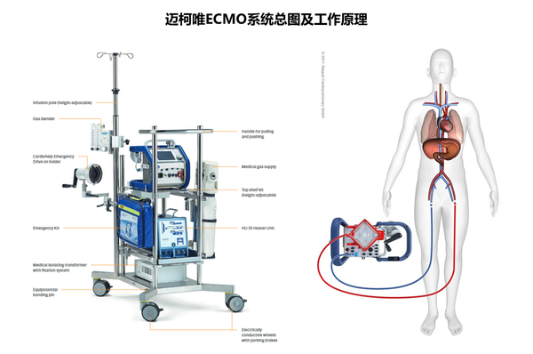 ECMO：向死而生，ICU危重症抢救的终极武器 - 知乎