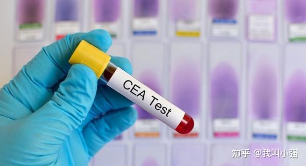癌症患者CEA升高意味着什么？是癌症复发转移了吗？ - 知乎