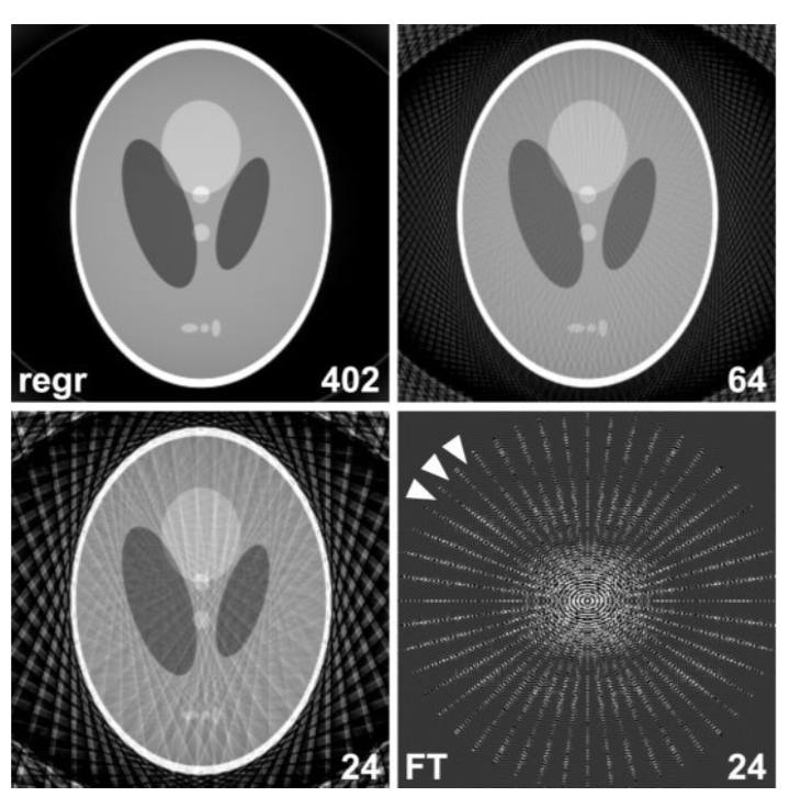 MRI Recon 经典论文（1） - 知乎