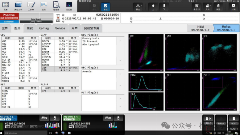 案例分析 | 一例弥漫大B细胞淋巴瘤的诊断历程 - 知乎