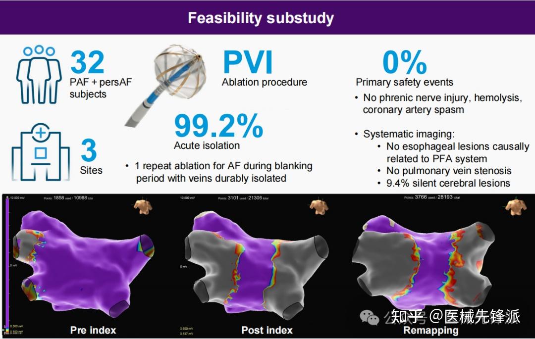 《Europace》文献分享----雅培Volt球囊篮脉冲场消融系统PFA的初步临床经验：急性CE标志可行性研究的结果 - 知乎