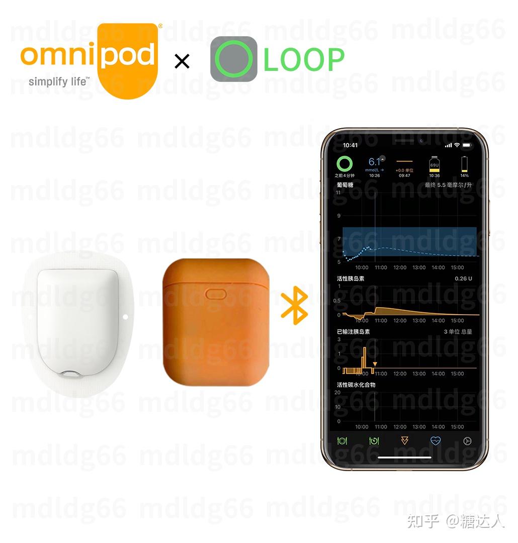 胰岛素泵闭环之——Omnipod DASH（无管路胰岛素泵） - 知乎