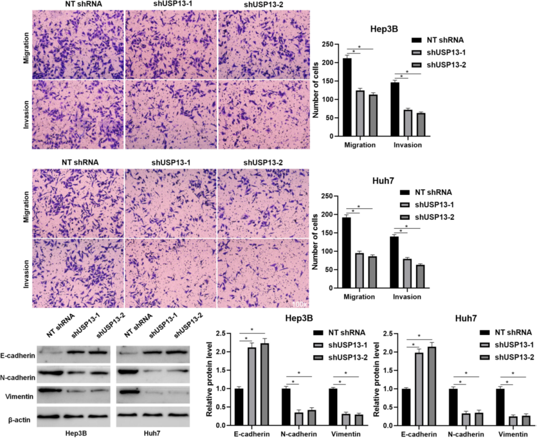 低氧诱导USP13通过增强Toll样受体TLR4/MyD88/NF-kB通路促进肝癌细胞肿瘤生长和转移 - 知乎