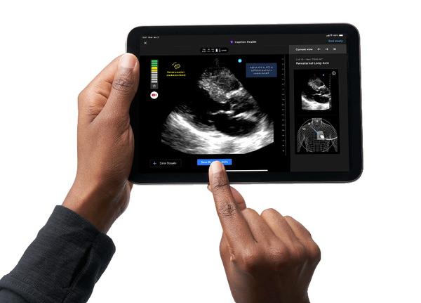 再次出手！GE医疗布局超声领域 - 知乎