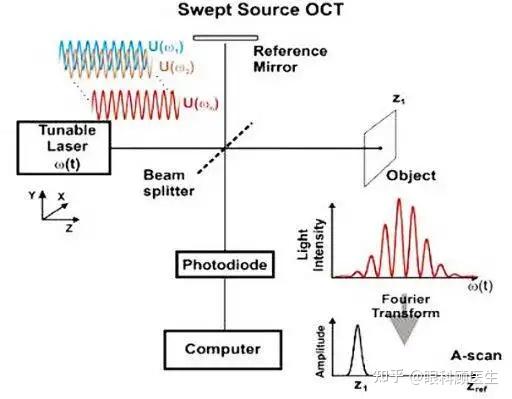 什么是OCT检查？ - 知乎