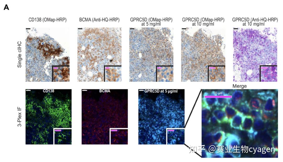 从GPRC5D看CAR-T靶点的发现与研究 - 知乎