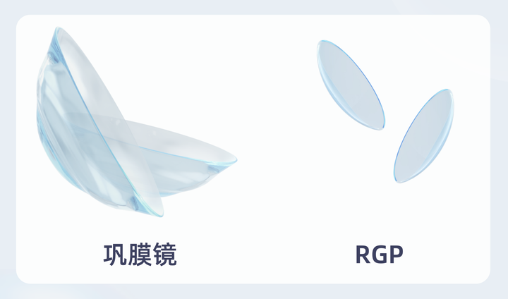 巩膜镜对比RGP，该如何选择？ - 知乎