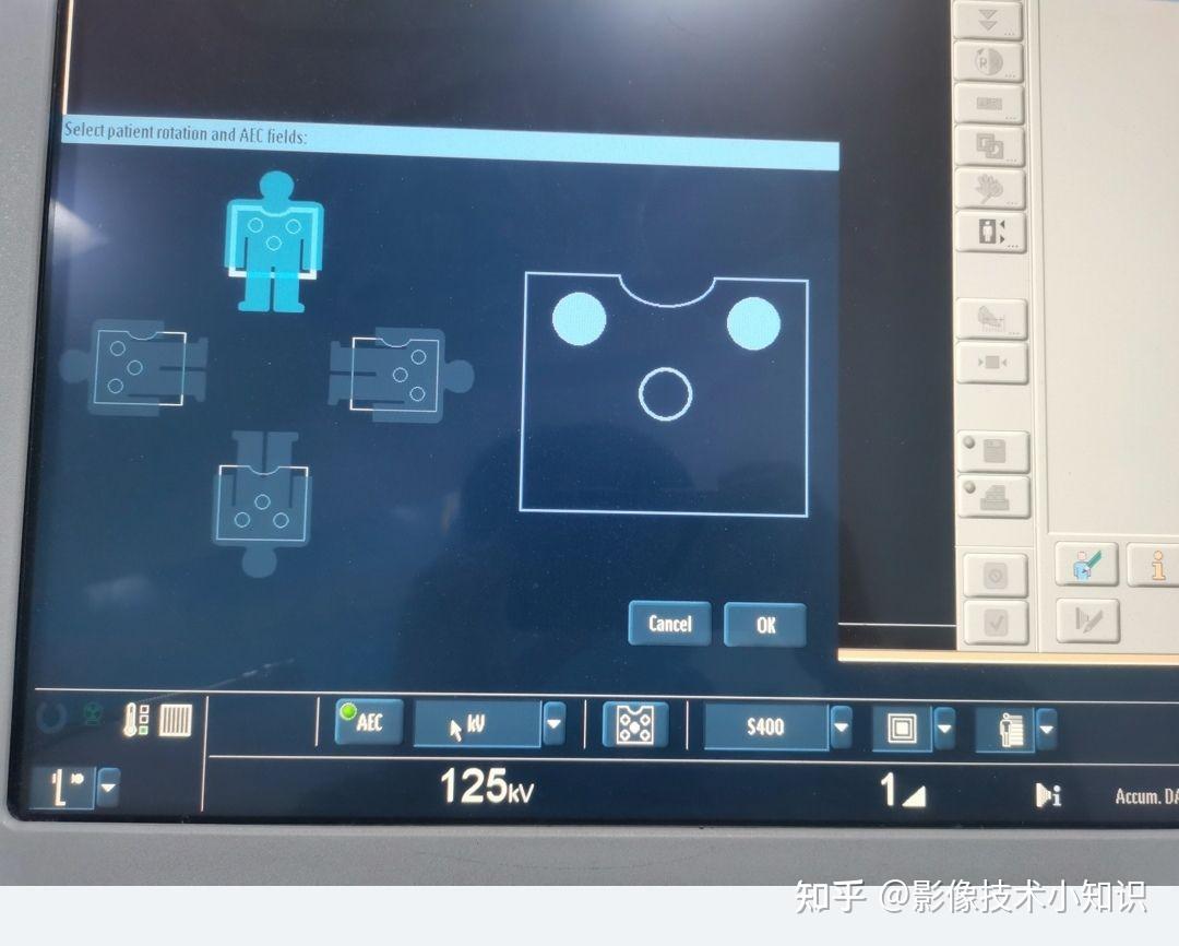 AEC的原理与应用 - 知乎