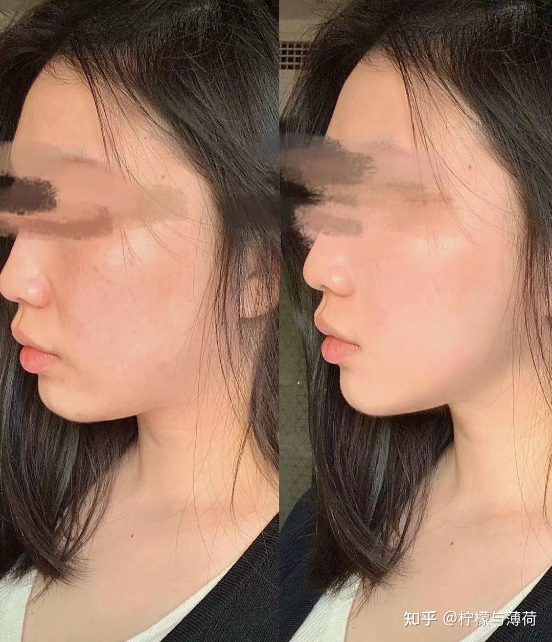 GEMO金茉美容仪好用吗？哪款最值得入手？内附GEMO金茉美容仪G20使用分享，买前必看！ - 知乎