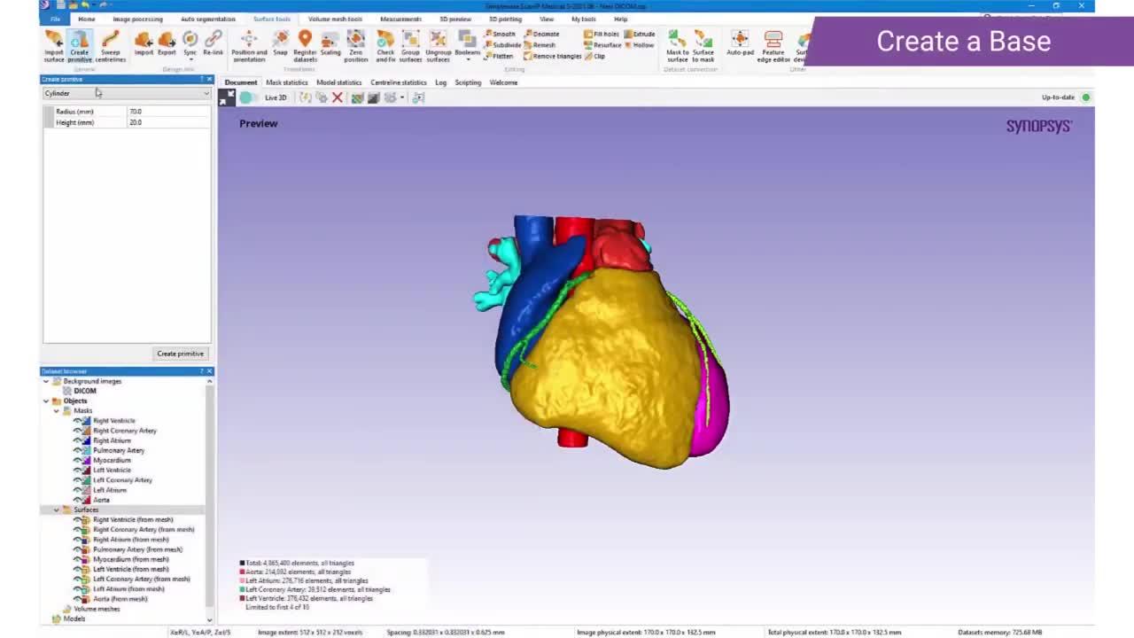 【Simpleware】Nicklaus儿童医院利用人工智能技术加速3D打印心脏模型 - 知乎