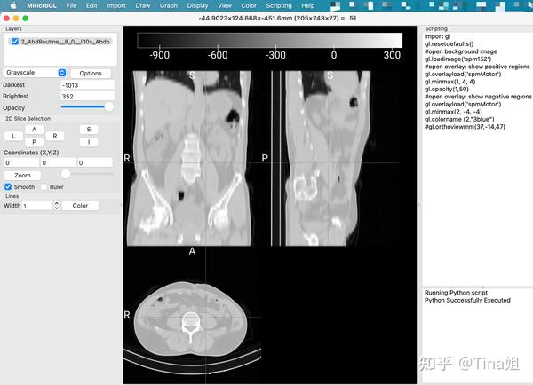 【最全】如何不写代码将 Dicom 图像转 Nifti 格式， 7种工具任你选！ - 知乎