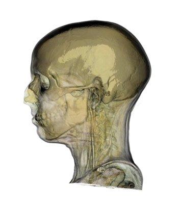 体渲染(二) - Texture Based Volume Rendering and Shear-Warp - 知乎