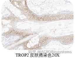 【IHC精准检测】——三阴性乳腺癌伴随诊断关键抗体：TROP-2 - 知乎