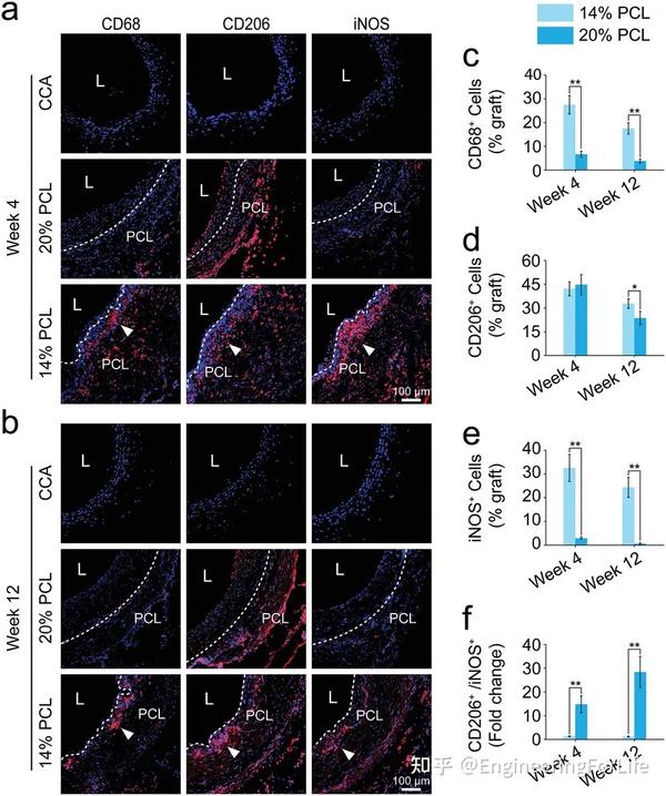 Small： PGS-PCL复合人工血管用于颈总动脉移植 - 知乎