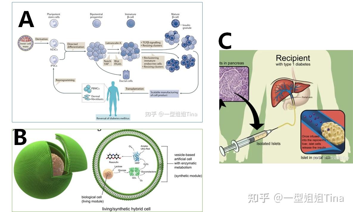 一文带你理清『糖尿病干细胞疗法』VX880和VX264 - 知乎