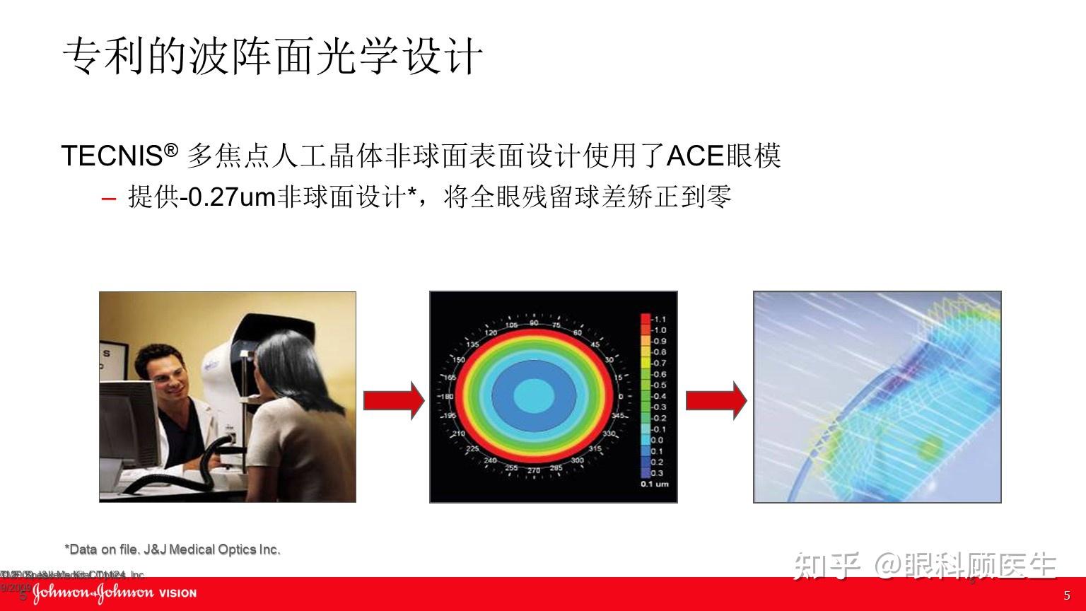 眼力健双焦点人工晶体-ZMB00的特点 - 知乎
