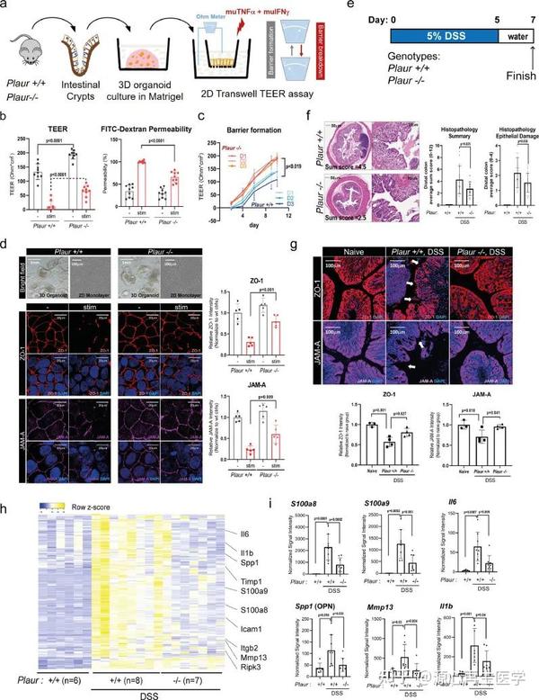 Lancet子刊丨IBD治疗新方向？uPA-uPAR有效调控肠黏膜屏障功能，提供抗炎新策略 - 知乎